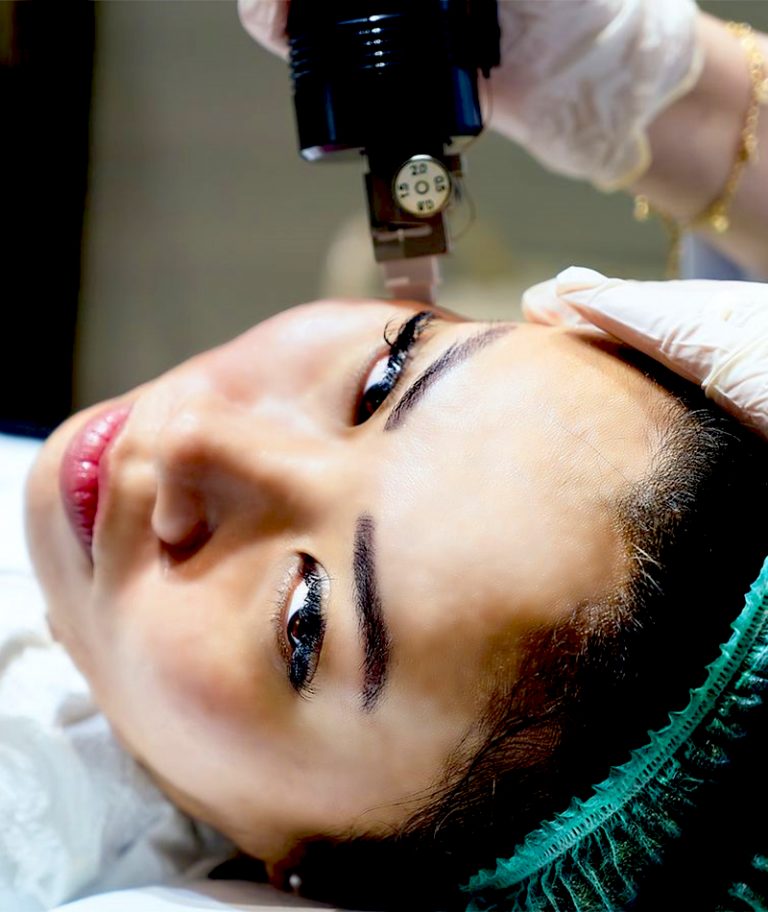 Body Radio Frequency Microneedling in Cobham | Smooth, Firm Skin